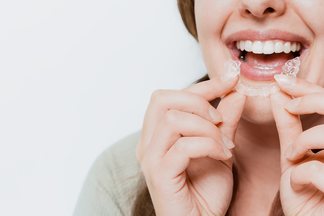 How to Keep Your Invisalign Aligners Stain-Free - Earlwood Orthodontics
